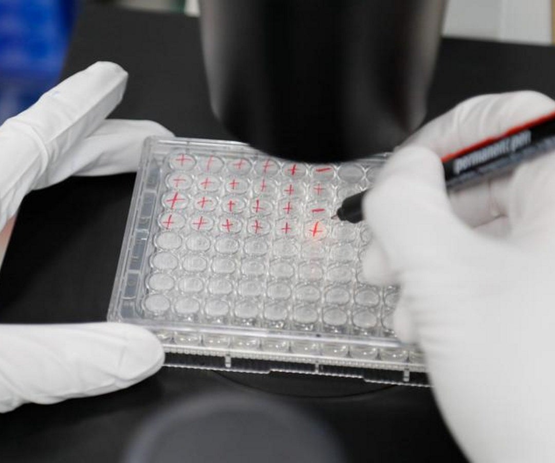 Ensayo de vacuna de Oxford contra la malaria apunta a que la enfermedad cambió